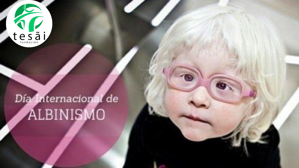 FUNDACIÓN TESÃI: Día Mundial de Sensibilización sobre el Albinismo ...